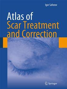 Atlas of scar treatment and correction - relié - Igor Safonov - Achat ...