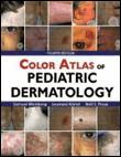 Color atlas pediatric dermatology - relié - Samuel Weinberg - Achat Livre | fnac