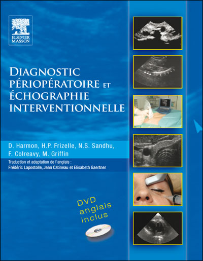 Diagnostic périopératoire et échographie interventionnelle - Livre CD ...