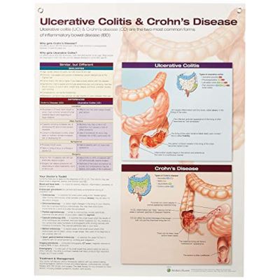 Ulcerative Colitis & Crohn's Disease Anatomical Chart Laminated ...