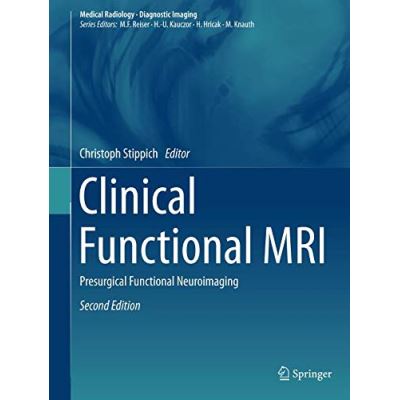Clinical Functional MRI: Presurgical Functional Neuroimaging (Medical ...