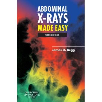 Abdominal X-rays Made Easy, Made Easy Series - broché - Achat Livre | fnac