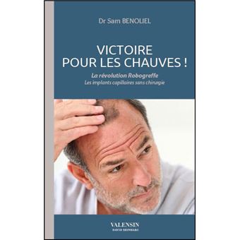 Victoire pour les chauves ! La révolution Robogreffe, Les implants ...