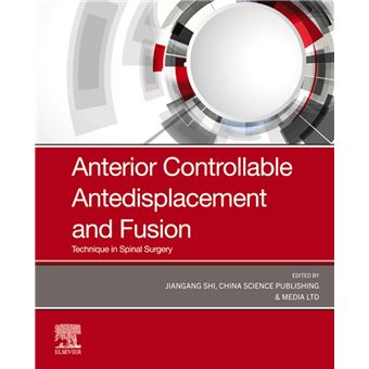 Anterior Controllable Antedisplacement and Fusion (ACAF) Technique in ...