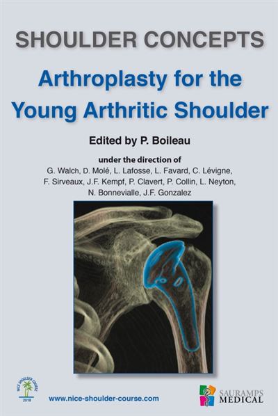 Shoulder concepts arthroplasty for the young arthritic shoulder Coll ...