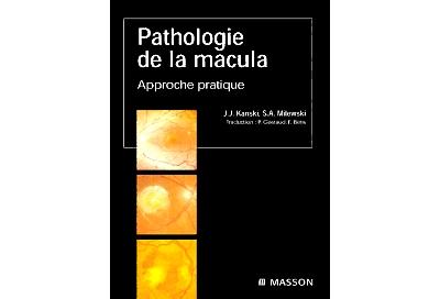 Pathologie de la macula Approche pratique - broché - Jack J. Kanski ...
