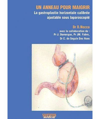 Un anneau pour maigrir La gastroplastie horizontale calibrée ajustable ...