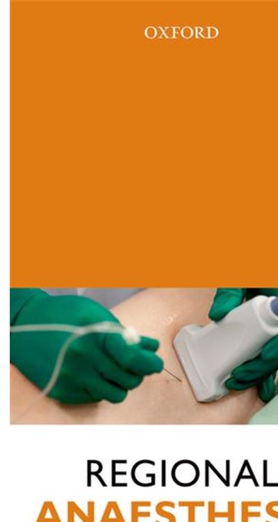 Regional Anaesthesia: A Pocket Guide - ebook (ePub) - Alwin Chuan ...