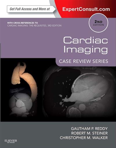 Cardiac imaging - Poche - Gautham P. Reddy, Robert M. Steiner - Achat ...