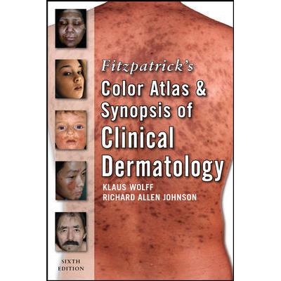 Fitzpatrick color atlas and synopsis of clinical dermatology - Poche ...