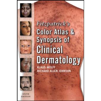 Fitzpatrick color atlas and synopsis of clinical dermatology - Poche ...