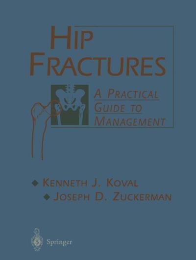 Hip fractures - relié - Kenneth Koval - Achat Livre ou ebook | fnac