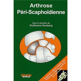Arthrose peri scaphoidienne «supplément, Steven Viegas, USA ...