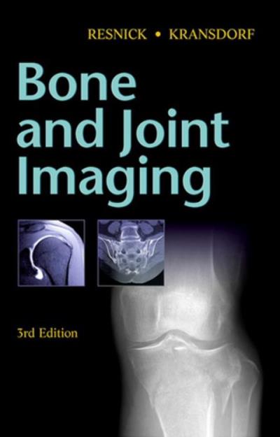 Bone and Joint Imaging - ebook (ePub) - Donald L. Resnick MD, Mark J ...