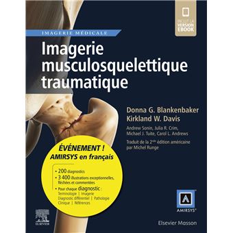 Imagerie musculosquelettique traumatique - broché - Donna G ...