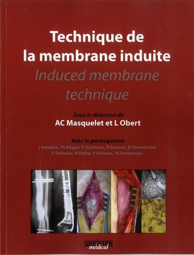 Technique de la membrane induite - induced membrane technique Edition ...