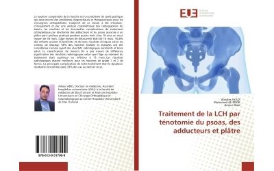 Traitement de la LCH par ténotomie du psoas, des adducteurs et plâtre ...