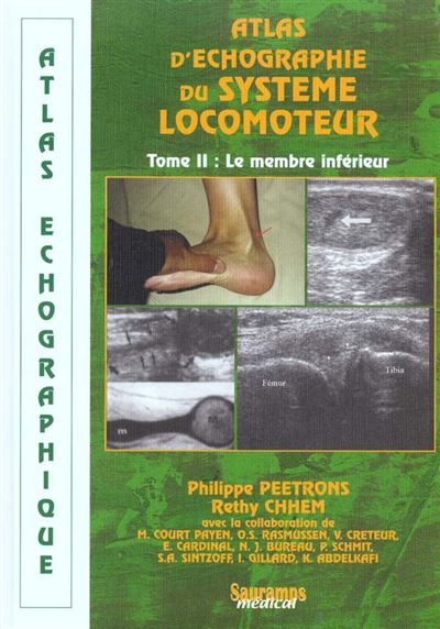 Atlas d'echographique du systeme locomoteur - tome ii - membre ...