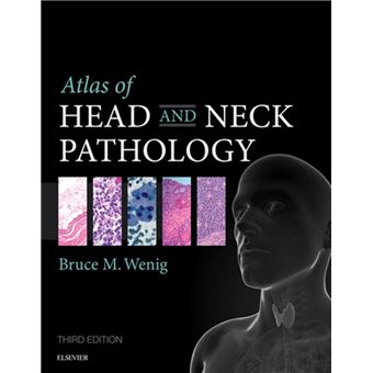 Atlas of head and neck pathology - Poche - Bruce M. Wenig - Achat Livre ...