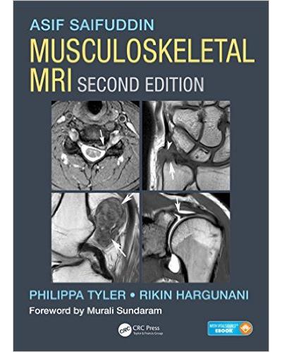 Musculoskeletal MRI - broché - Asif Saifuddin - Achat Livre ou ebook | fnac
