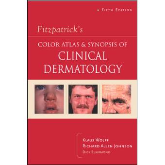 Color atlas & synopsis of clinical dermatology - Poche - Thomas Fitzpatrick - Achat Livre | fnac