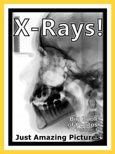 Just X-Ray Photos! Big Book of Photographs & Pictures of X-Rays ...