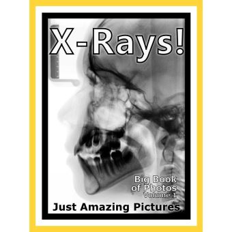 Just X-Ray Photos! Big Book of Photographs & Pictures of X-Rays ...