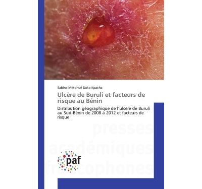 Ulcère de Buruli et facteurs de risque au Bénin Distribution ...