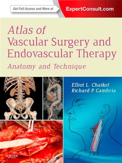 Atlas of vascular surgery and endovascular therapy - Poche - Elliot L ...
