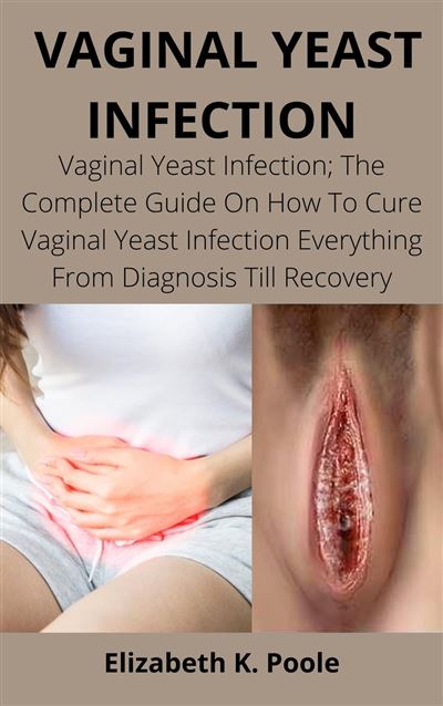 Female yeast infection store