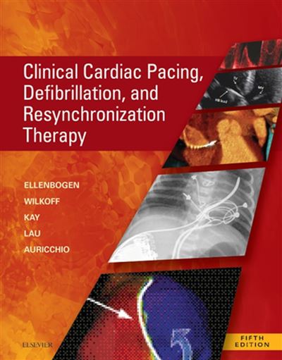 Clinical cardiac pacing, defibrillation and rtesynchronization therapy ...