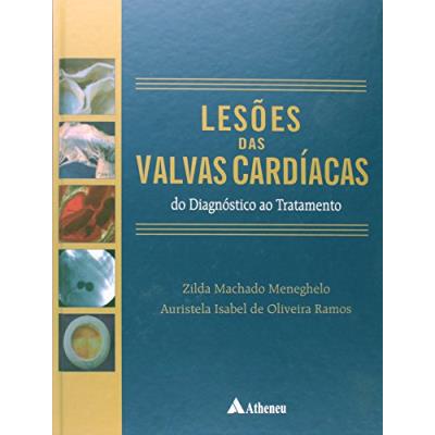 Lesões Das Valvas Cardíacas.Do Diagnostico Ao Tratamento Lesões Das ...