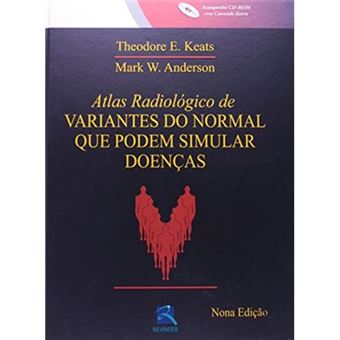 Atlas Radiol.Variantes Normal Que Podem Simular Doencas Keats - Outros ...