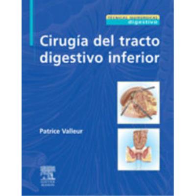 Cirugía del tracto digestivo inferior Técnias quirúrgicas Patrice ...