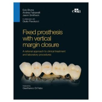 Fixed Prosthesis With Vertical Margin Closure Andrea Bruna Ezio ...