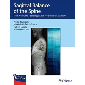 Sagittal Balance Of The Spine From Normal To Pathology A Key For ...