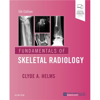 Fundamentals of skeletal radiology - HELMS, CLYDE A., HELMS, CLYDE A ...
