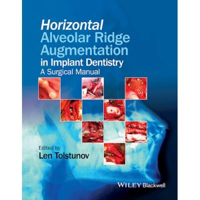 Horizontal alveolar ridge augmentat - TOLSTUNOV, LEN, Tolstunov, L ...