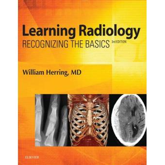 Learning Radiology: Recognizing the Basics 3rd Edition - Brochado - HERRING, WILLIAM, William ...