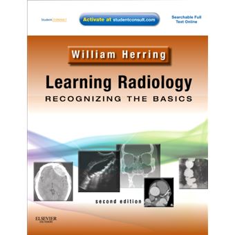Learning Radiology: Recognizing the Basics 2nd Edition - Brochado ...