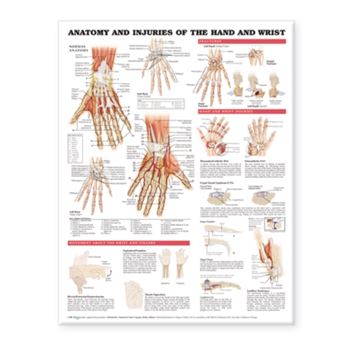 Anatomy and Injuries of the Hand and Wrist Anatomical Chart - broché ...