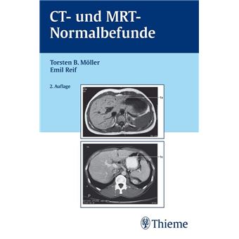 CT- und MRT-Normalbefunde - 2. Auflage | Torsten B. Möller Torsten B ...