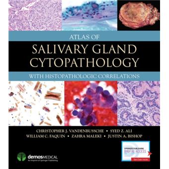Atlas of Salivary Gland Cytopathology by Bishop & Justin & MD Dr ...