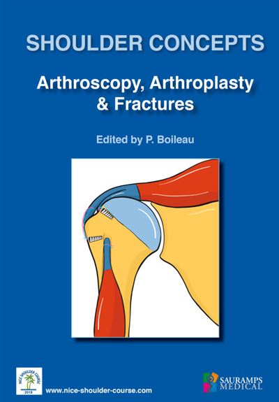 Shoulder concepts arthroscopy arthrosplasty & fractures Coll nice ...