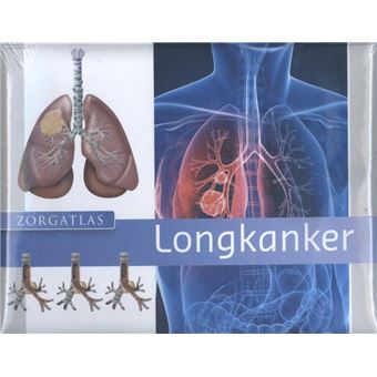 Zorgatlas - Longkanker - Sander De Hosson, Yvonne Schut - cartonné ...