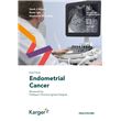 Fast Facts: Endometrial Cancer - ebook (ePub) - Sarah J. Kitson, Rema ...