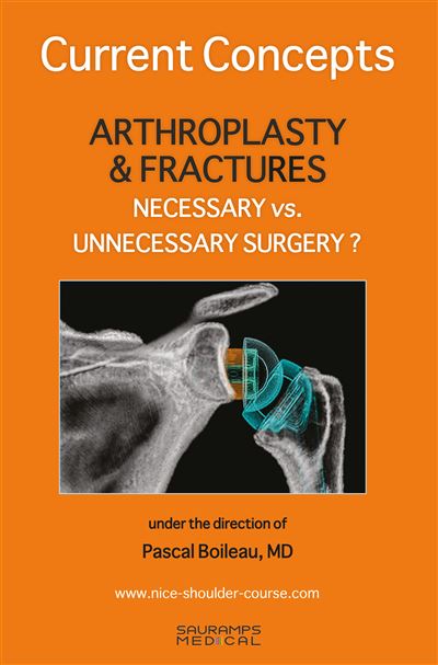 Current concepts. Arthroplasty & fractures necessary vs. unnecessary ...
