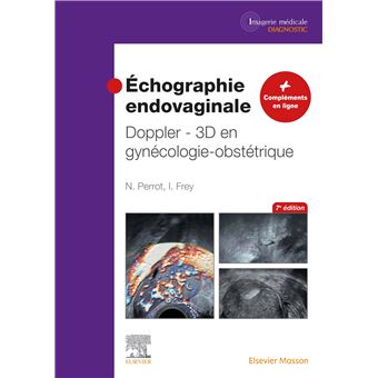 Échographie endovaginale Doppler - 3D En gynécologie-obstétrique ...