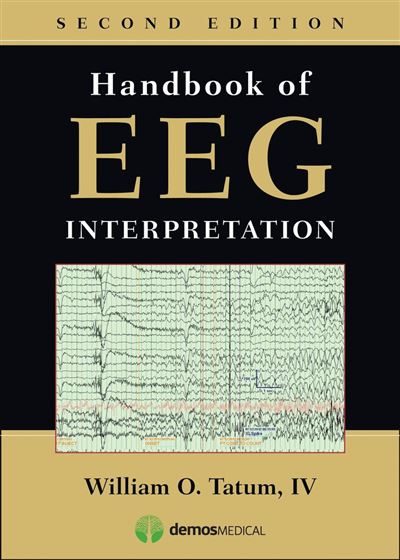 Handbook of EEG Interpretation, Second Edition - ebook (ePub) - William ...